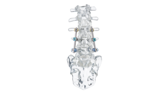 uCentum™ – Thorakolumbosakrales Stab-Schrauben-System