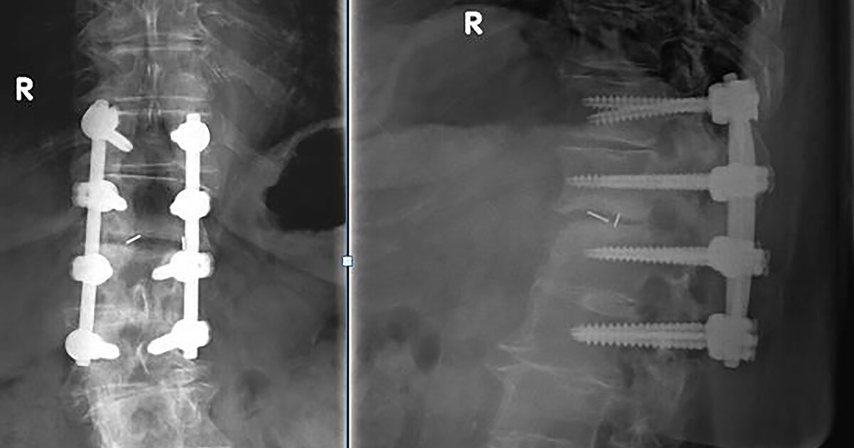 Case study: uCentum™ - Dr. Kast
