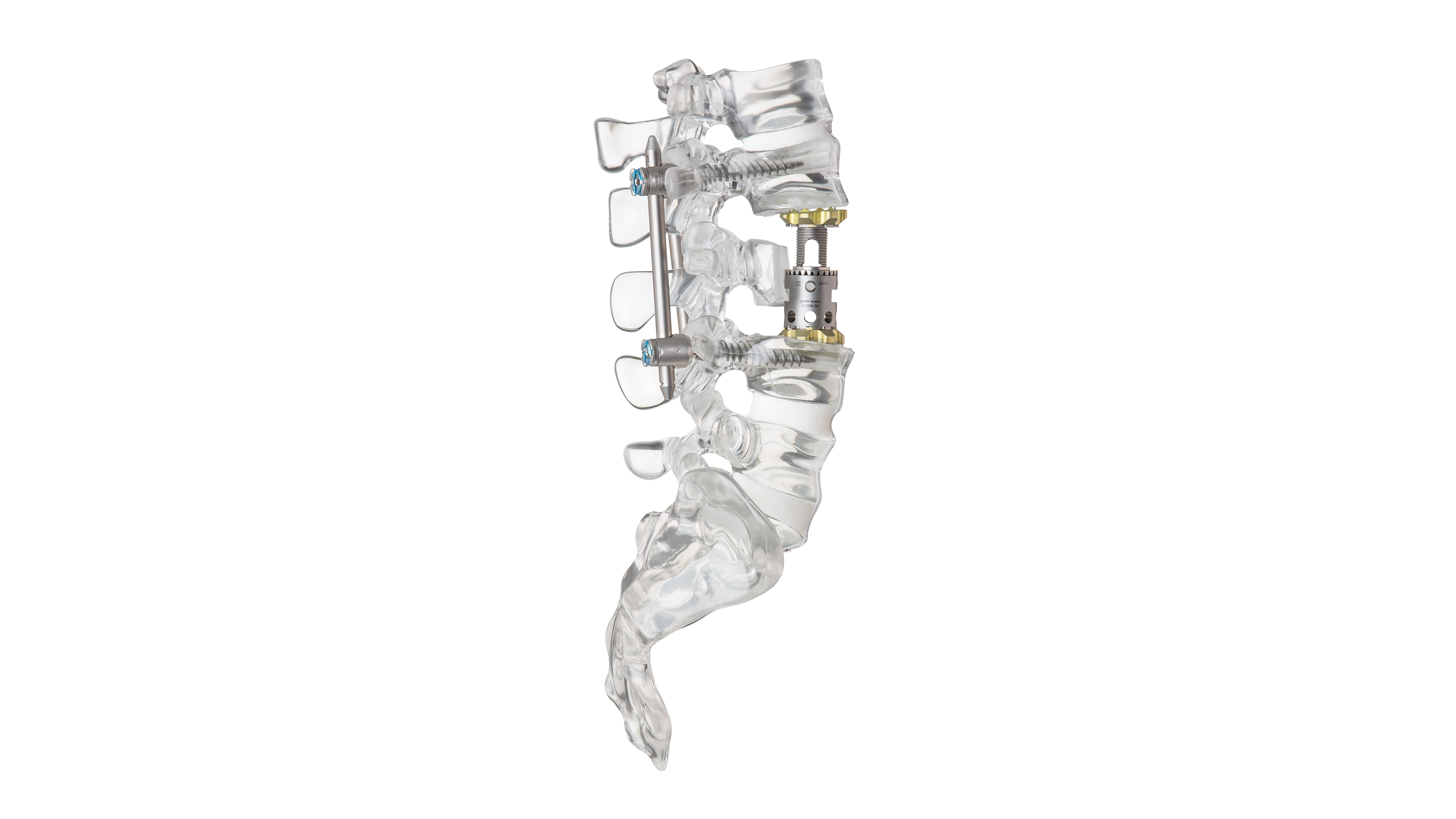 Product comparison CT contrast media injectors