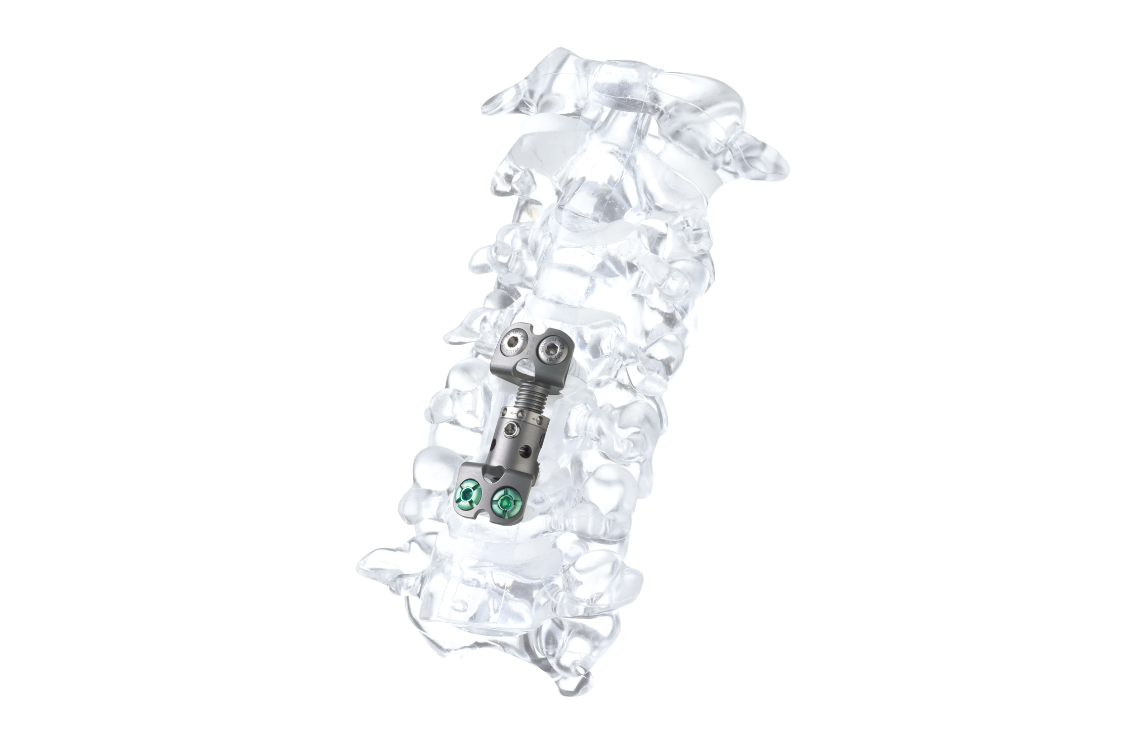 ADD™plus – vertebral body replacement with integrated plates