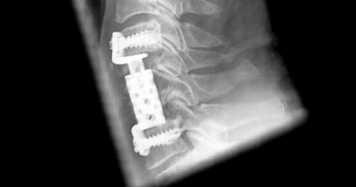 Case study: ADDplus™