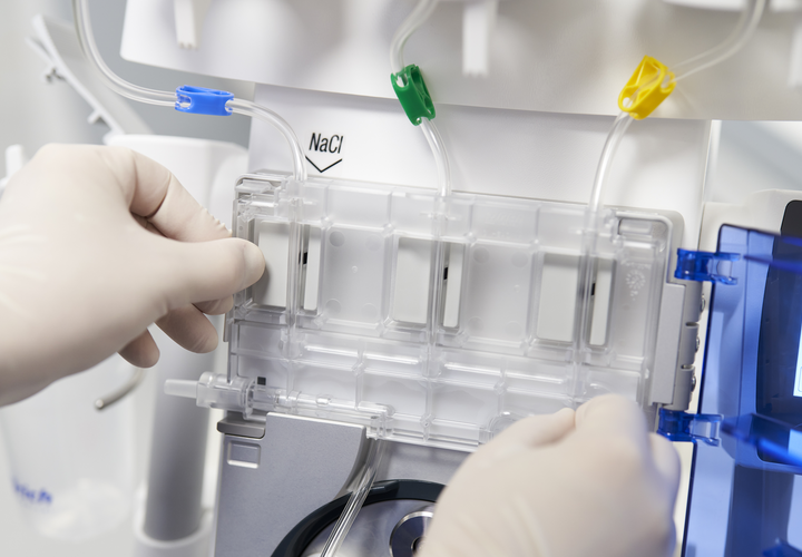 Contrast-enhanced mammography