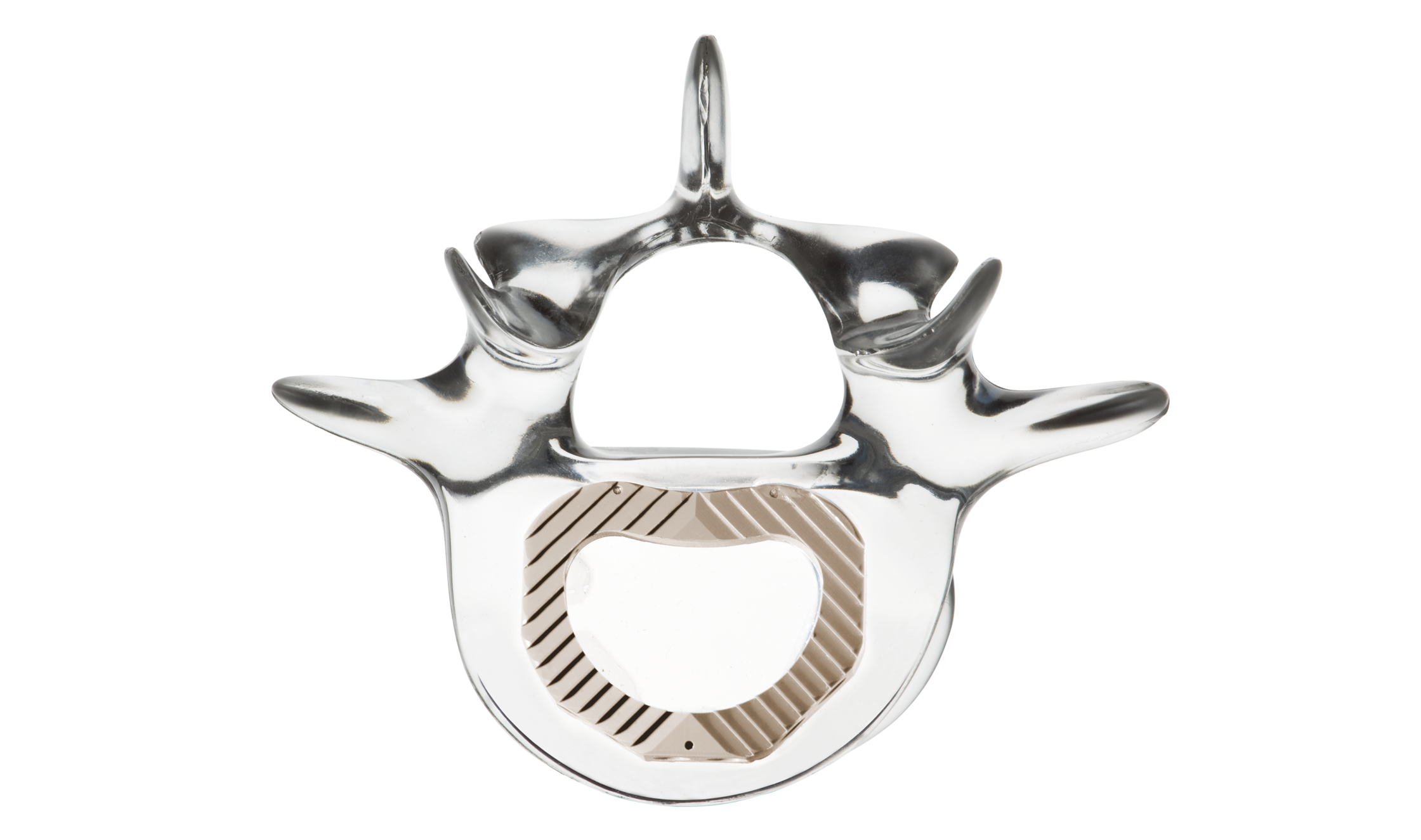pezo™ – PEEK Cage Familie